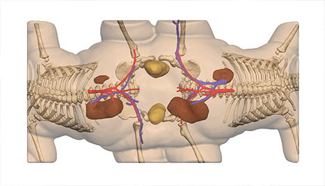 Delivering a new life to Hernandez-Torres conjoined twins with 3D ...